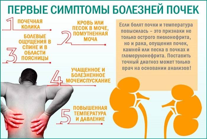 Топ 10 препаратов для лечения почек Статьи Поиск Лекарств